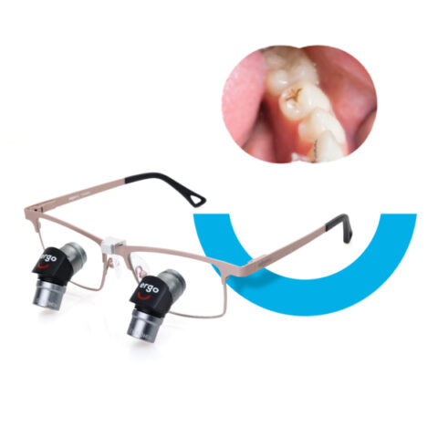 Ergo Loupes - ANDAU MEDICAL