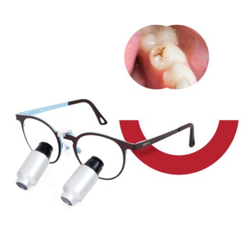 Prismatic Loupes - ANDAU MEDICAL