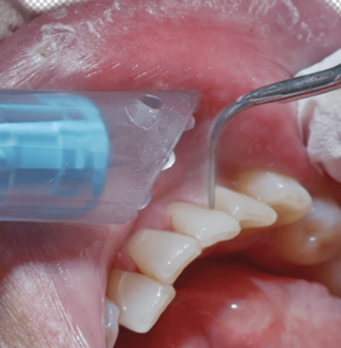 ErgoFinger - ANDAU MEDICAL